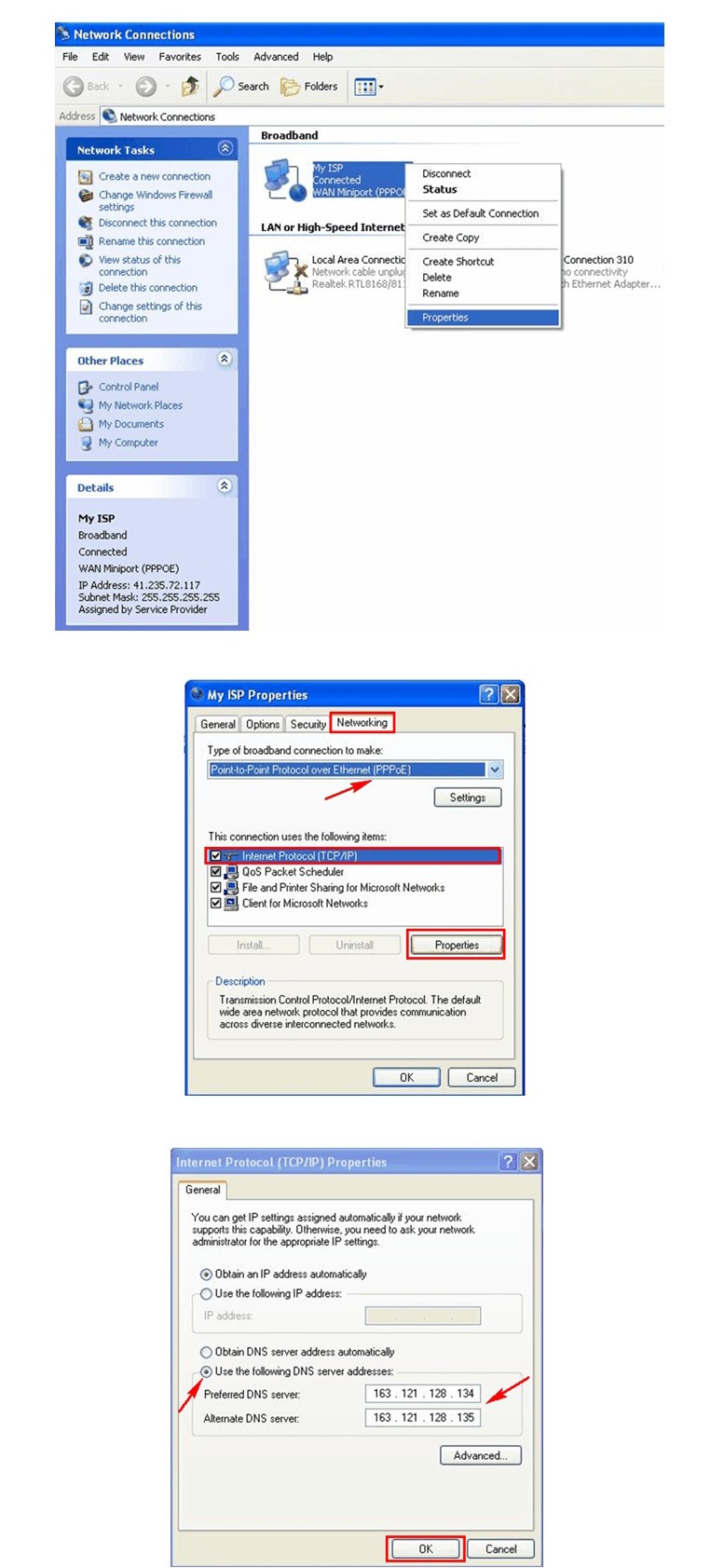 Speedtouch 330 Setup - تذكرة نت